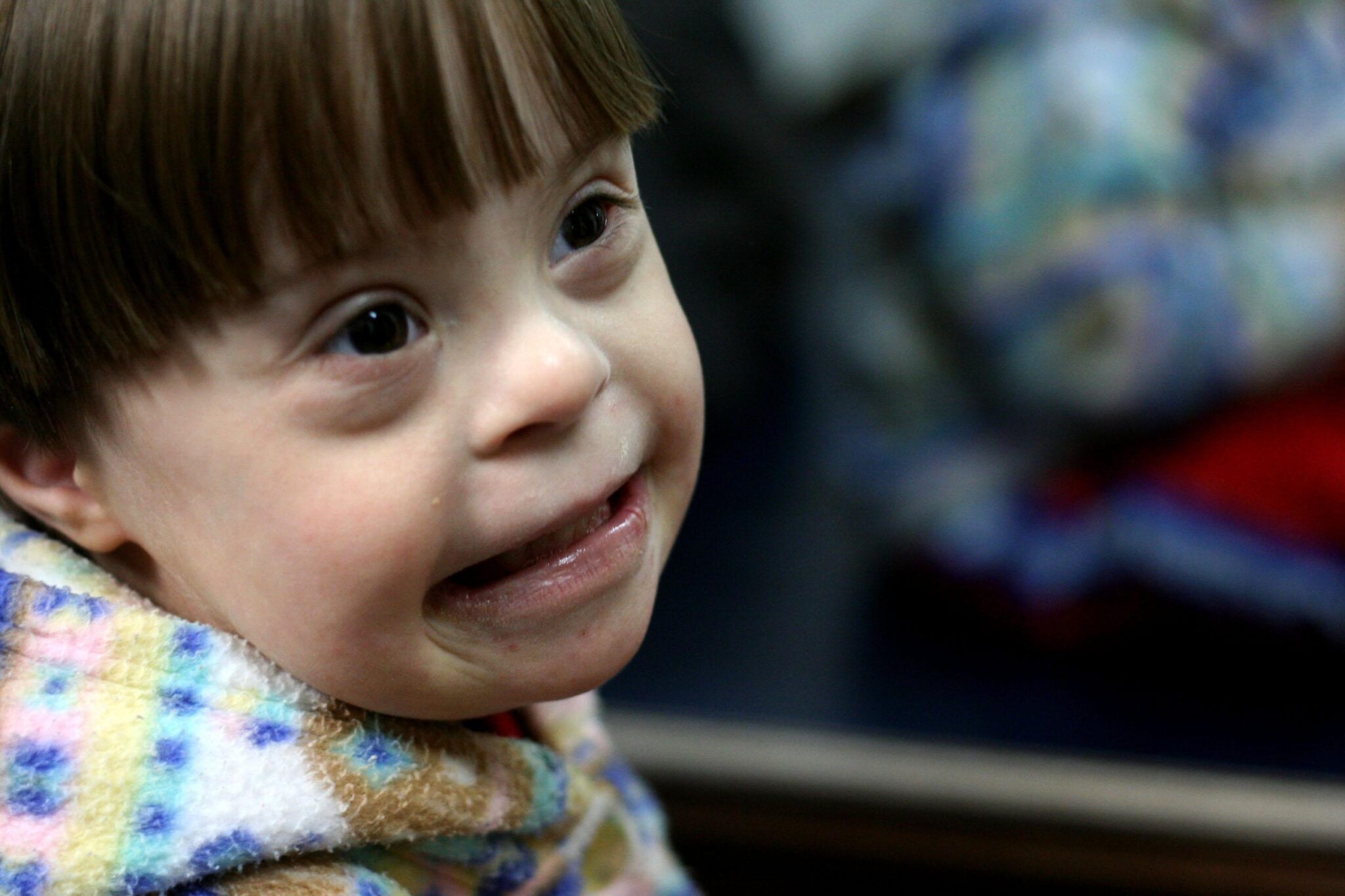 Síndrome de Down: causas y síntomas | CEFEGEN